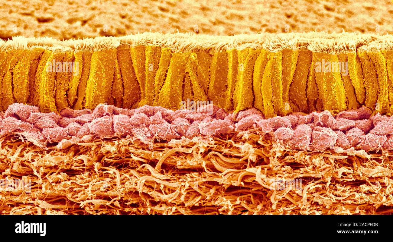 Trachea lining. Coloured scanning electron micrograph (SEM) of a ...