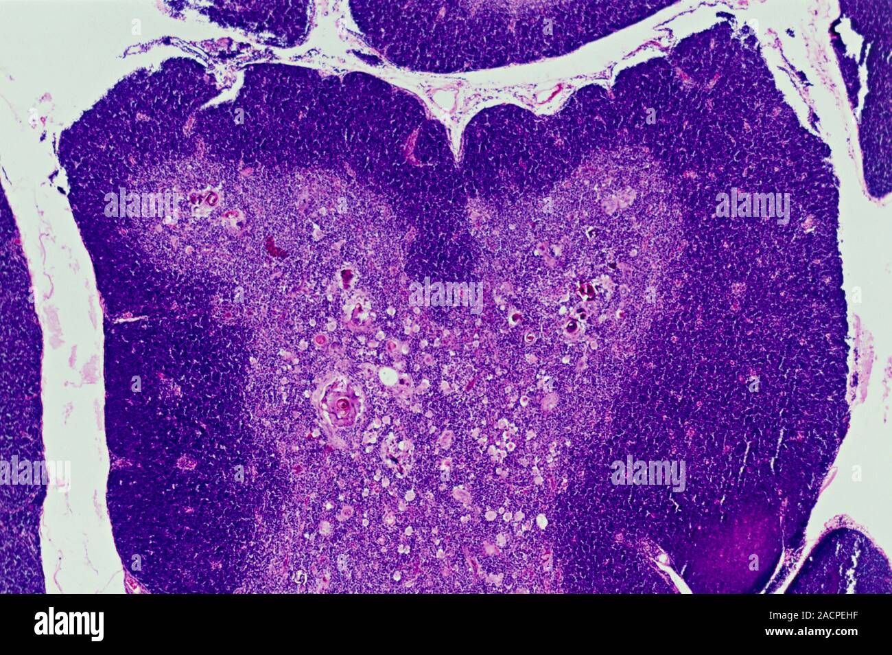 Thymus. Light micrograph of a section through par of a thymic lobule ...