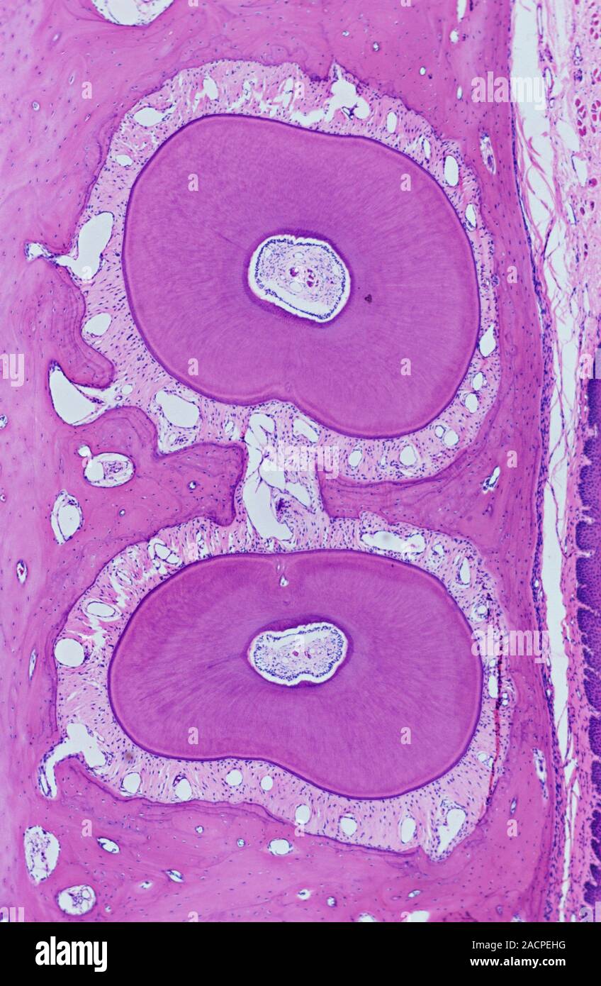 Tooth. Light micrograph of a section through the roots of a tooth ...
