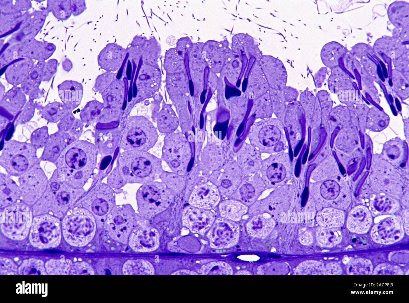 Sperm production. Light micrograph of a section through the epithelium ...