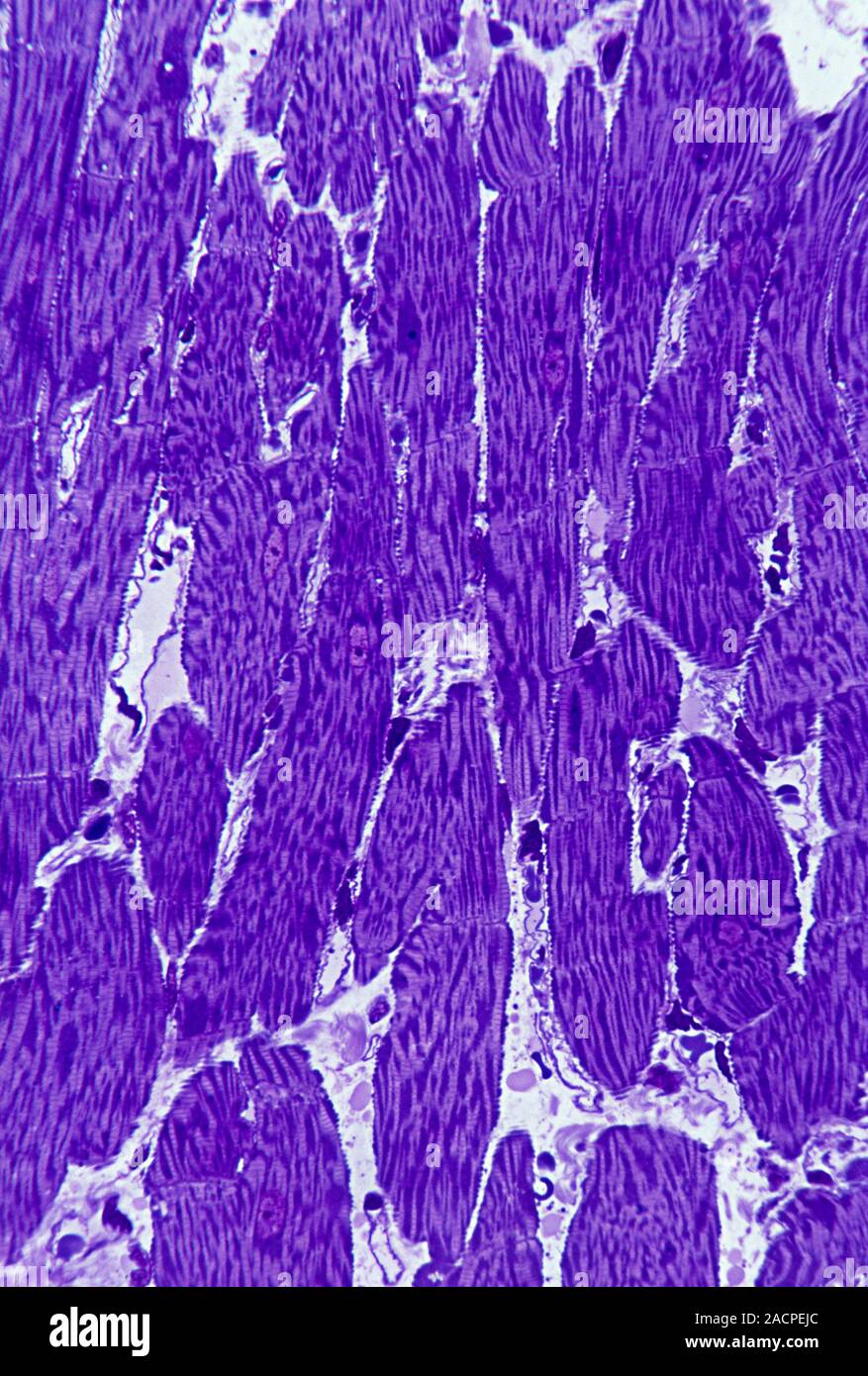 Heart muscle. Light micrograph of a section through heart (cardiac ...