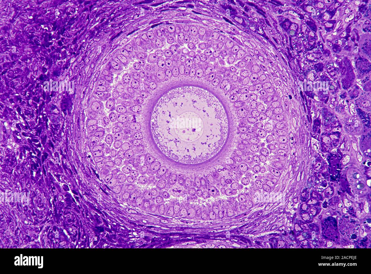 Ovarian follicle. Light micrograph of a section through a secondary ...