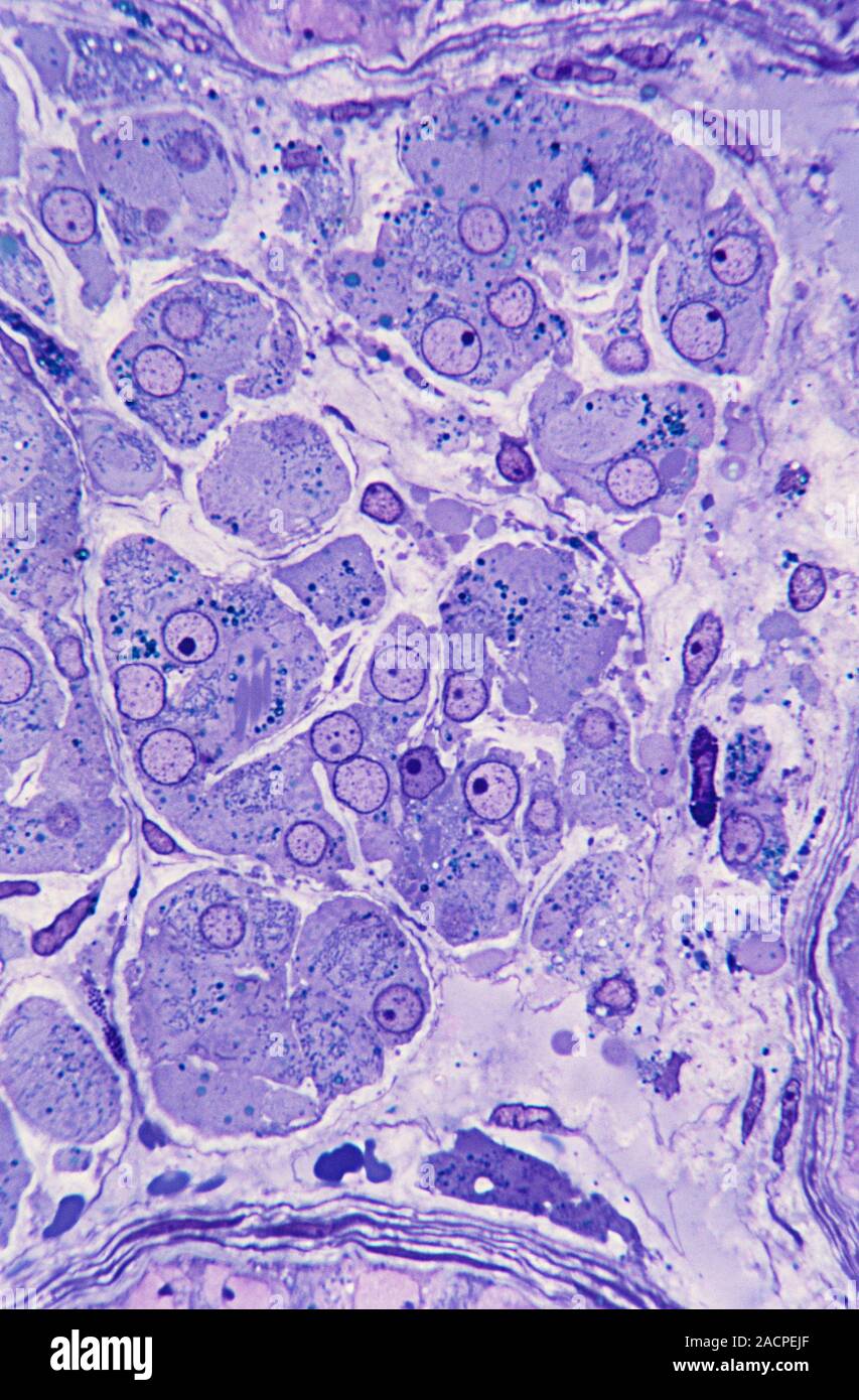 Leydig Cells Light Micrograph Of A Section Through Leydig Cells In A