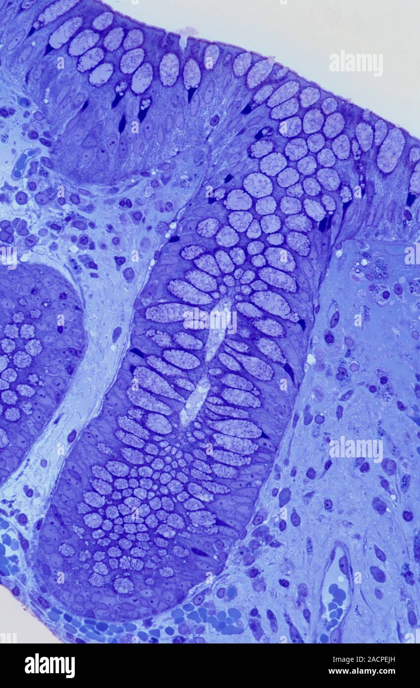 Large intestine. Light micrograph of a section through the epithelial ...