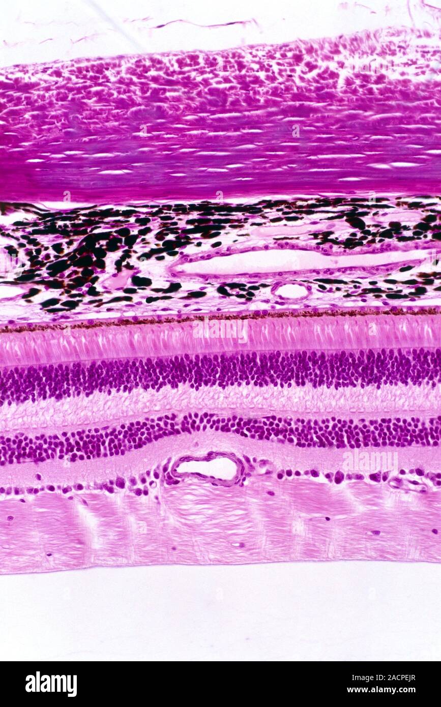 Retina of the eye. Light micrograph of a section through the retina ...