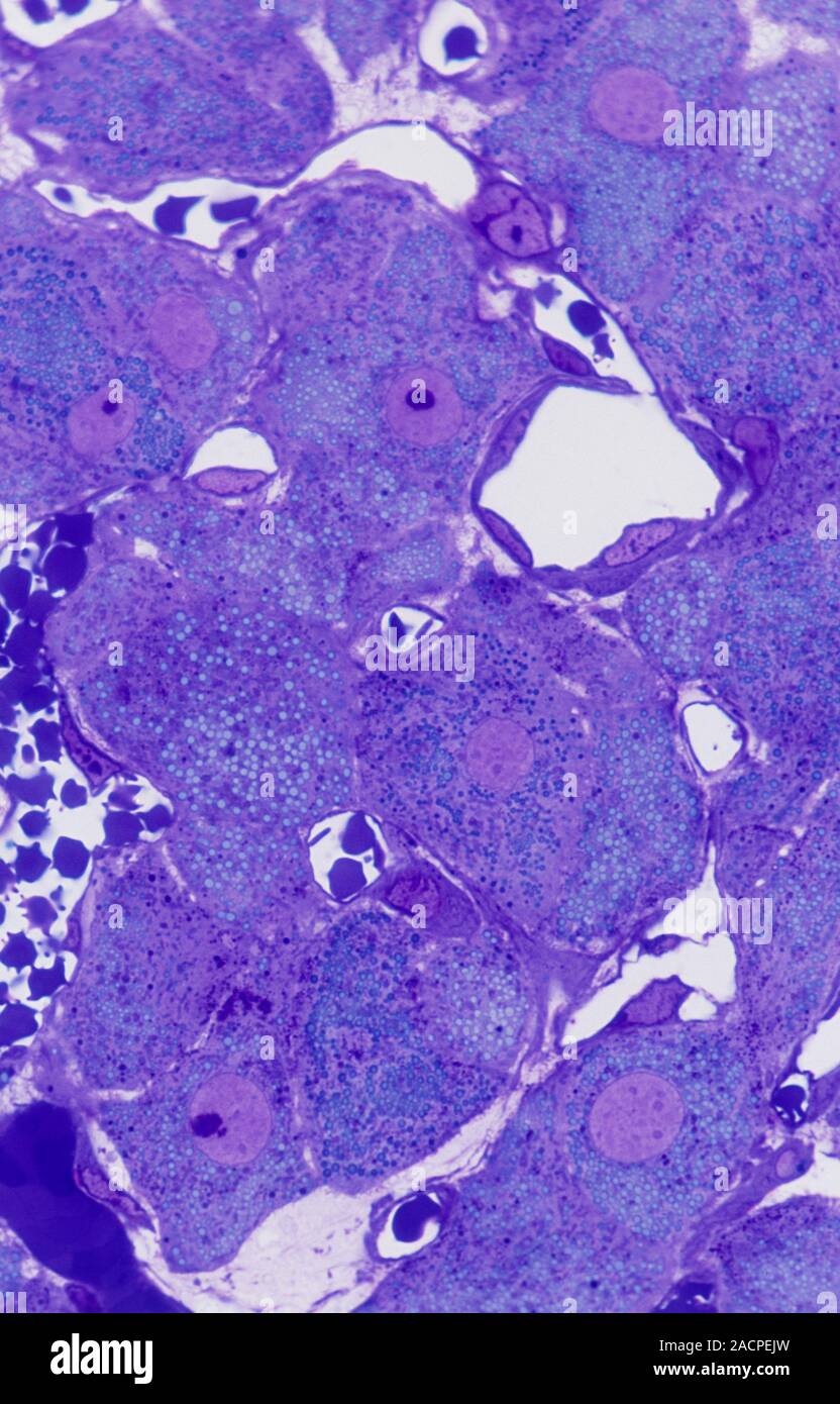 Corpus luteum of ovary. Light micrograph of a section through steroid ...