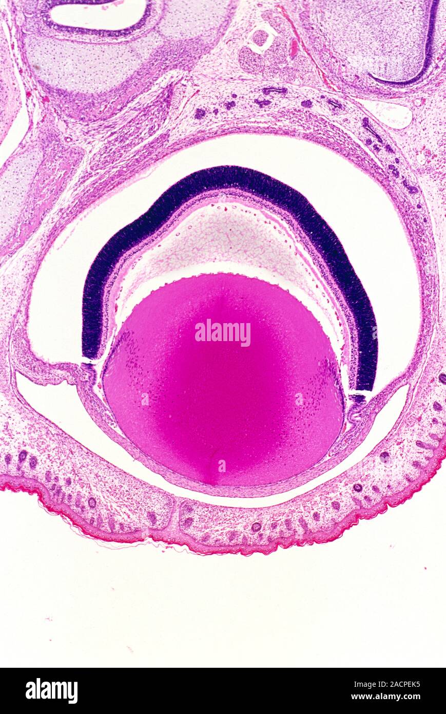 Foetal eye. Light micrograph of a section through the developing eye of ...