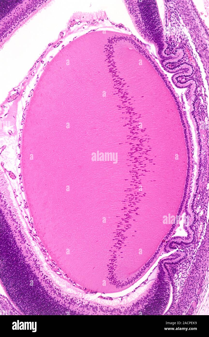 Foetal lens development. Light micrograph of a section through the lens ...