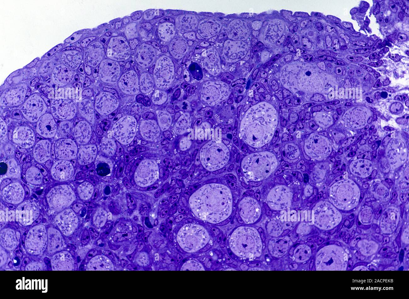 Ovarian primordial follicles. Light micrograph of a section through the ...