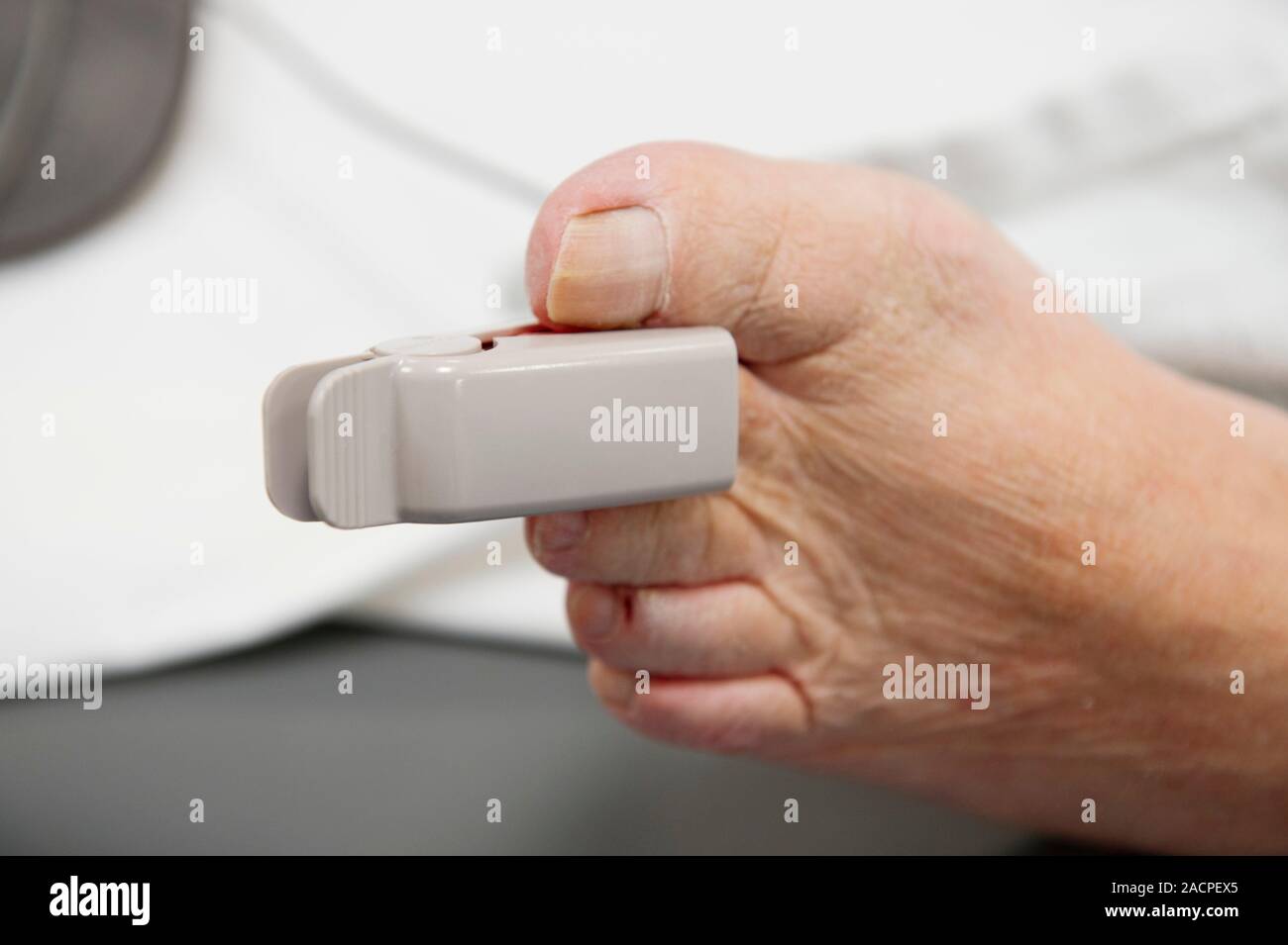 Blood oxygen monitor on the toe of a patient during surgery. This ...