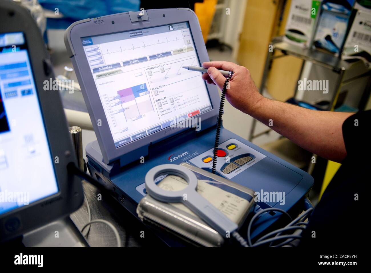 Implantable defibrillator surgery. Surgeon inputting the settings for a ...
