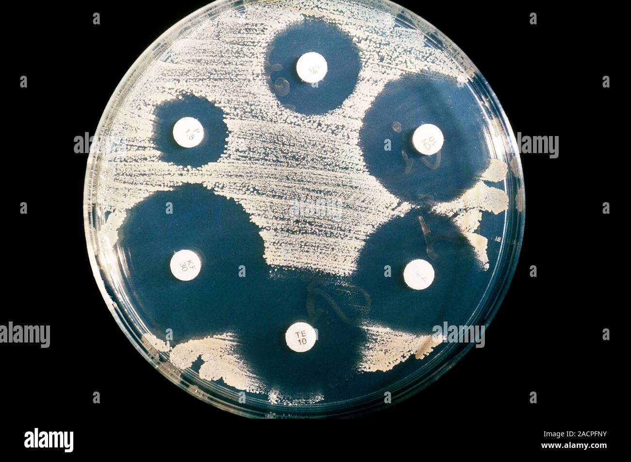 Antibiotic sensitivity test. Antibiotic discs placed on a bacterial ...