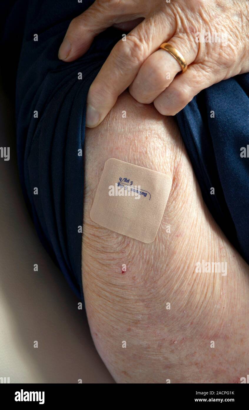 Transdermal pain relief. Close-up of a transdermal pain relief patch on ...