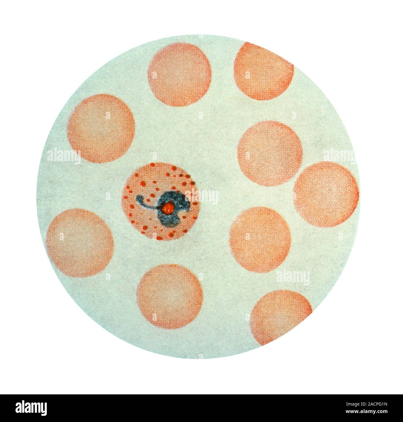 Malaria parasite in red blood cell. Light micrograph of a red blood ...