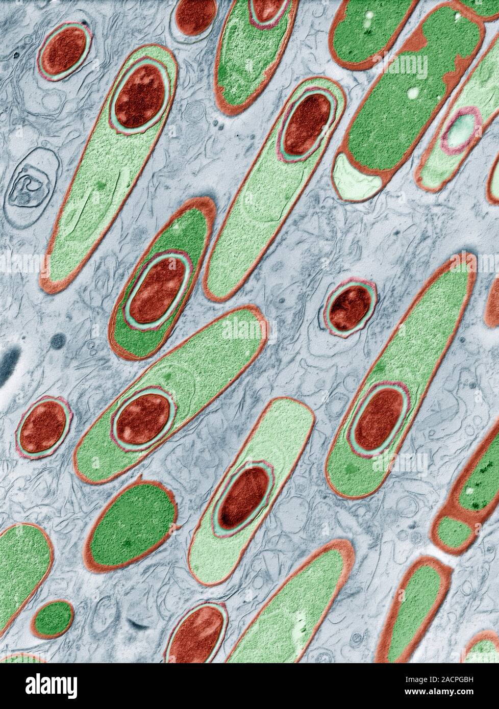 Anthrax bacteria. Coloured transmission electron micrograph (TEM) of a ...