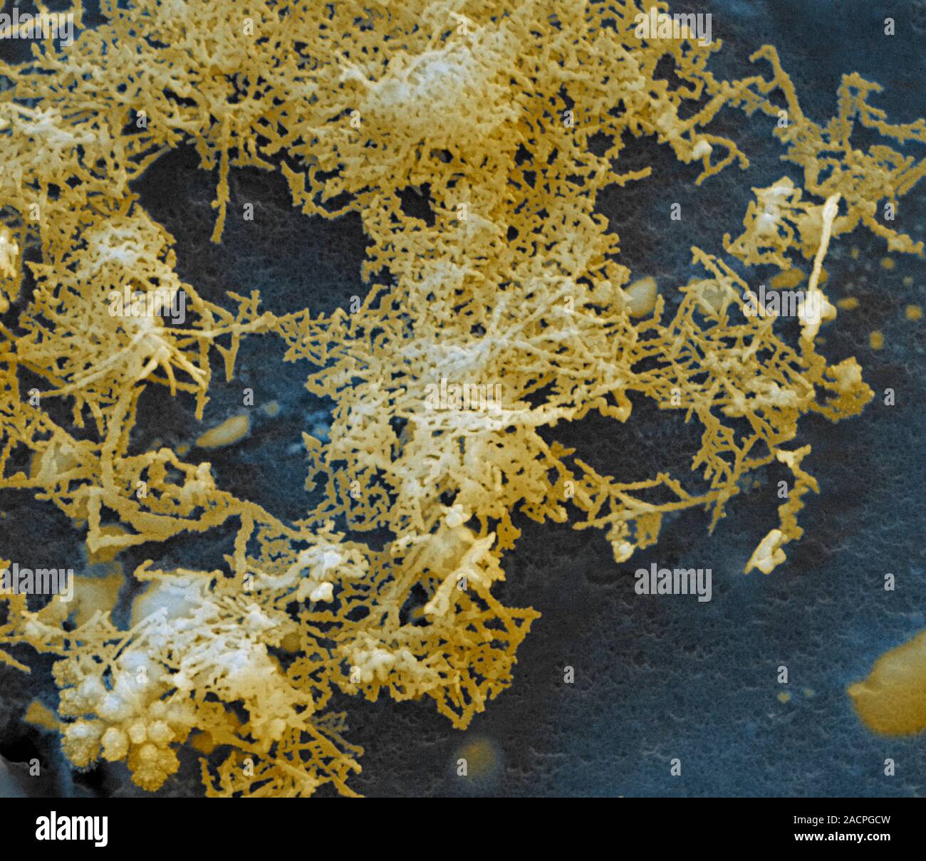 Precipitated gold crystals. Coloured scanning electron micrograph (SEM ...