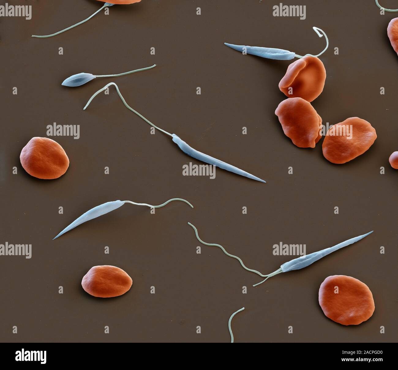 Leishmania protozoa and blood cells. Coloured scanning electron ...