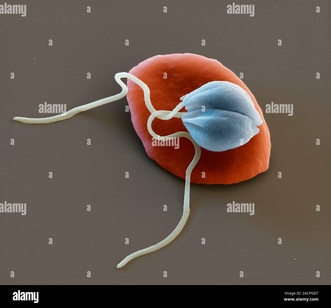 Leishmania protozoa and blood cell. Coloured scanning electron ...