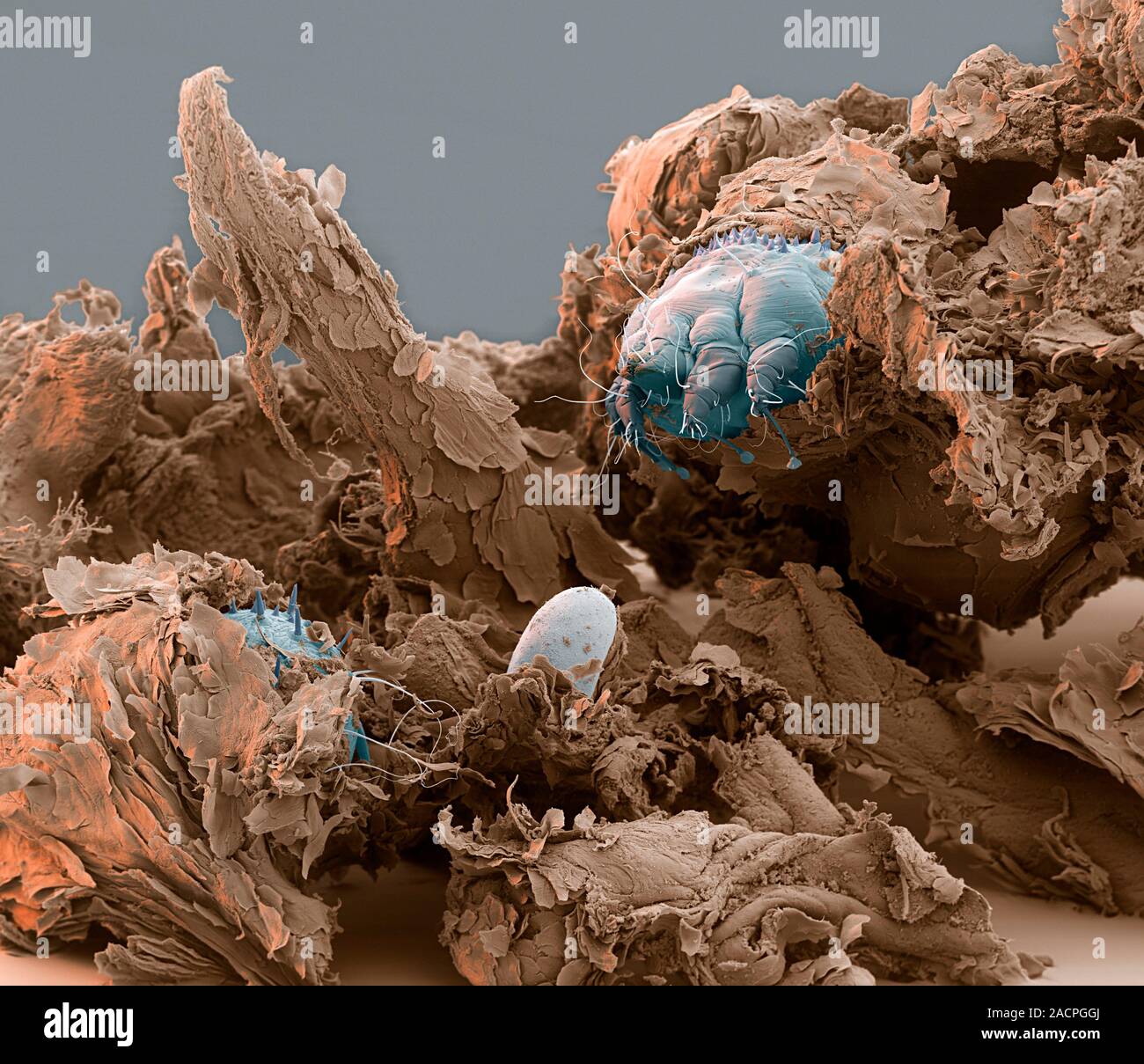 Scabies mites. Coloured scanning electron micrograph of two itch mites ...