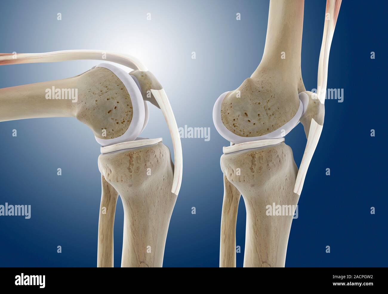 Knee flexion anatomy. Artwork of a side (lateral) view of the bones and ...