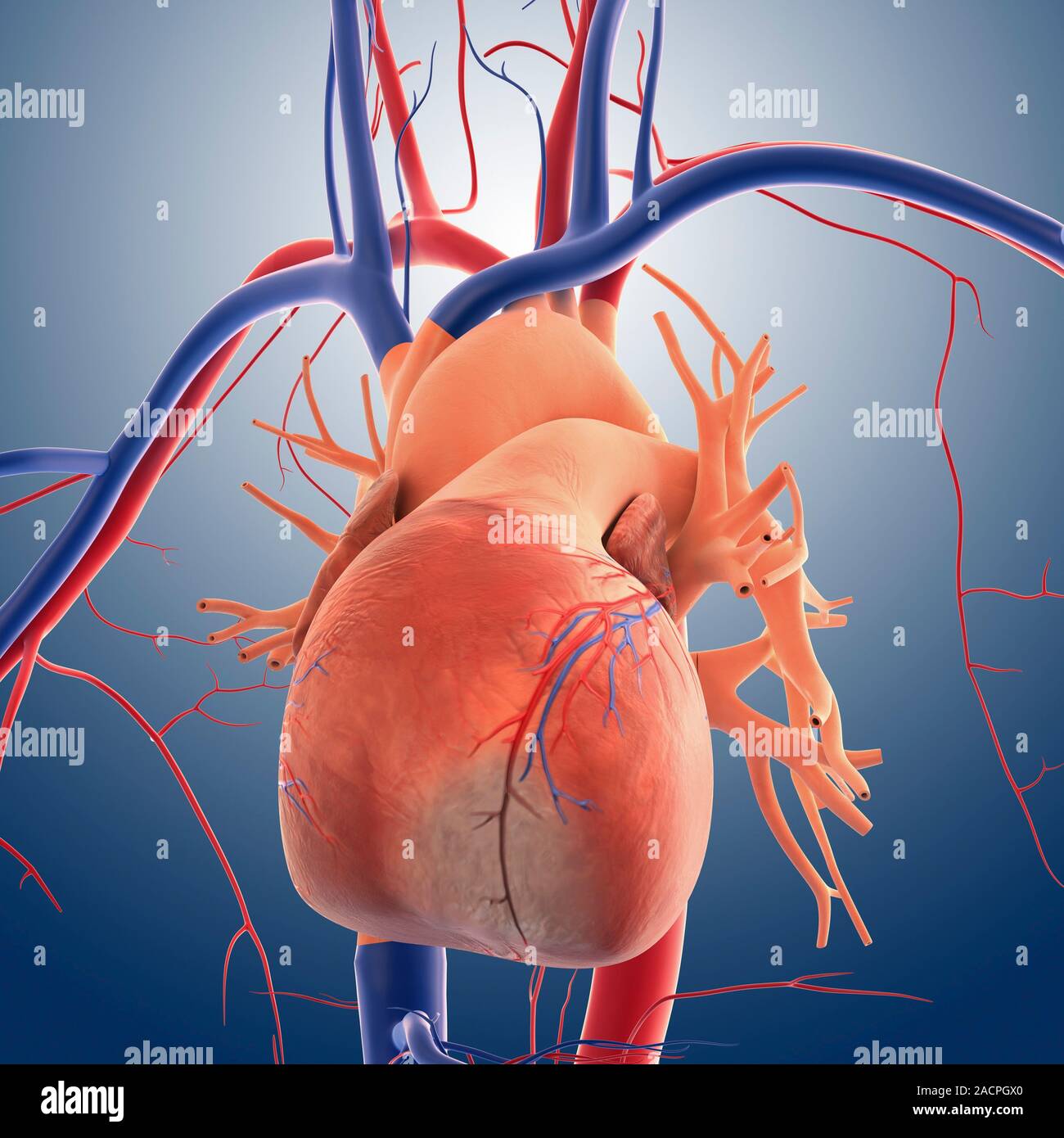 Heart attack. Artwork showing an anterior (frontal) view of a human ...
