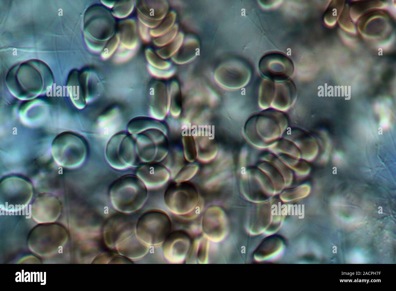 Red blood cells. Differential interference contrast (DIC) micrograph of ...