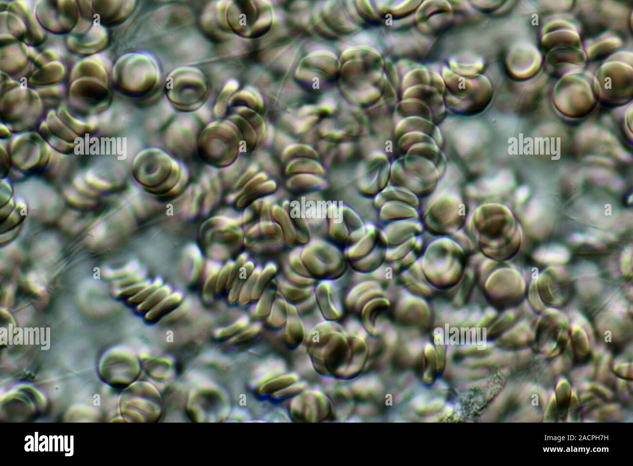 Red blood cells. Differential interference contrast (DIC) micrograph of ...