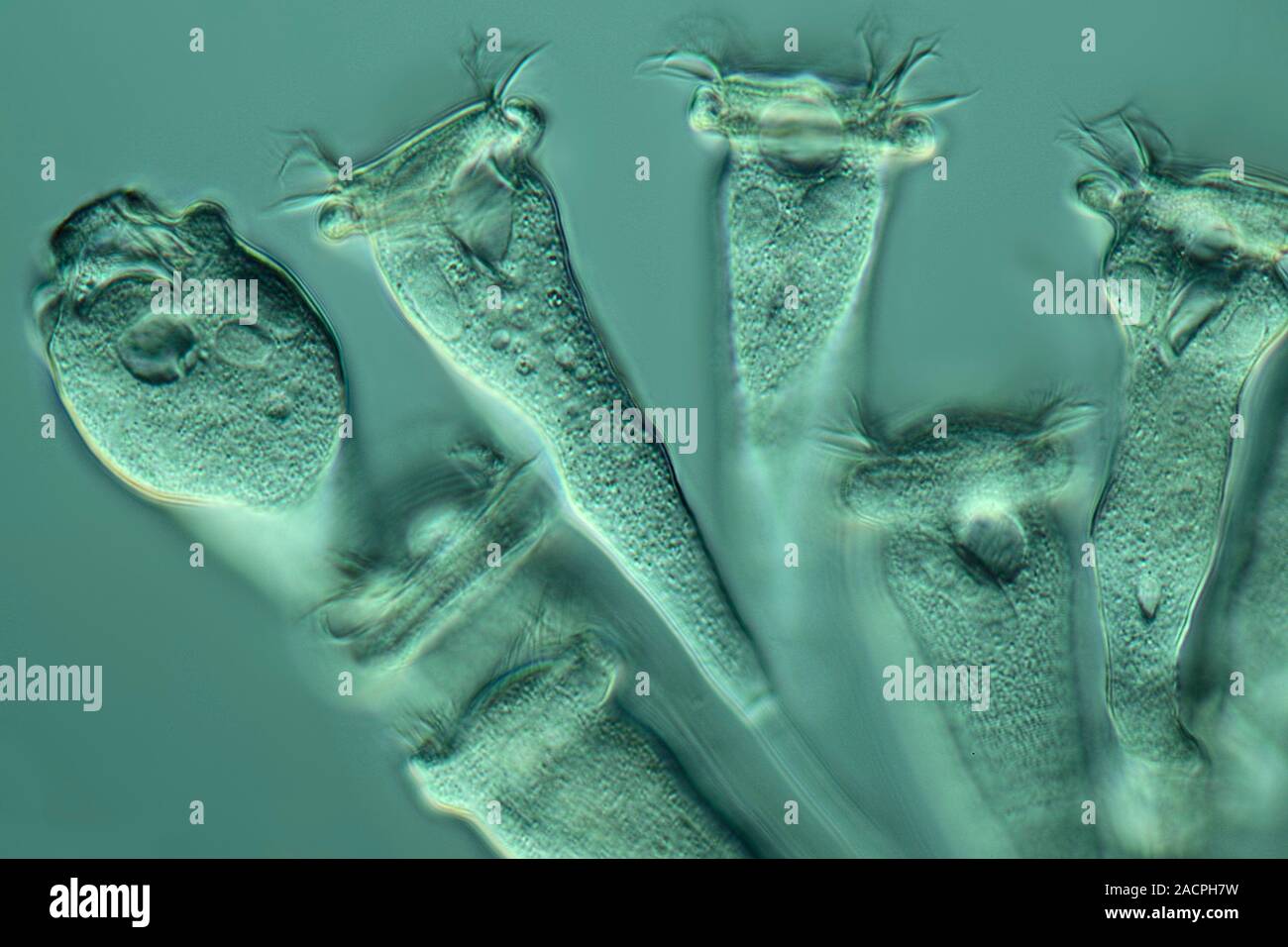 Vorticella protozoa. Differential interference contrast (DIC) light ... Vorticella protozoa. Differential interference contrast (DIC) light ...