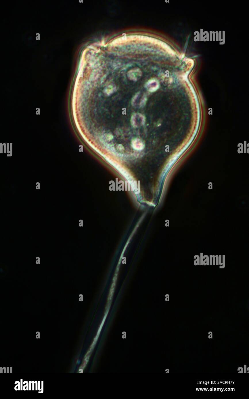 Vorticella protozoan. Differential interference contrast (DIC) light ... Vorticella protozoan. Differential interference contrast (DIC) light ...
