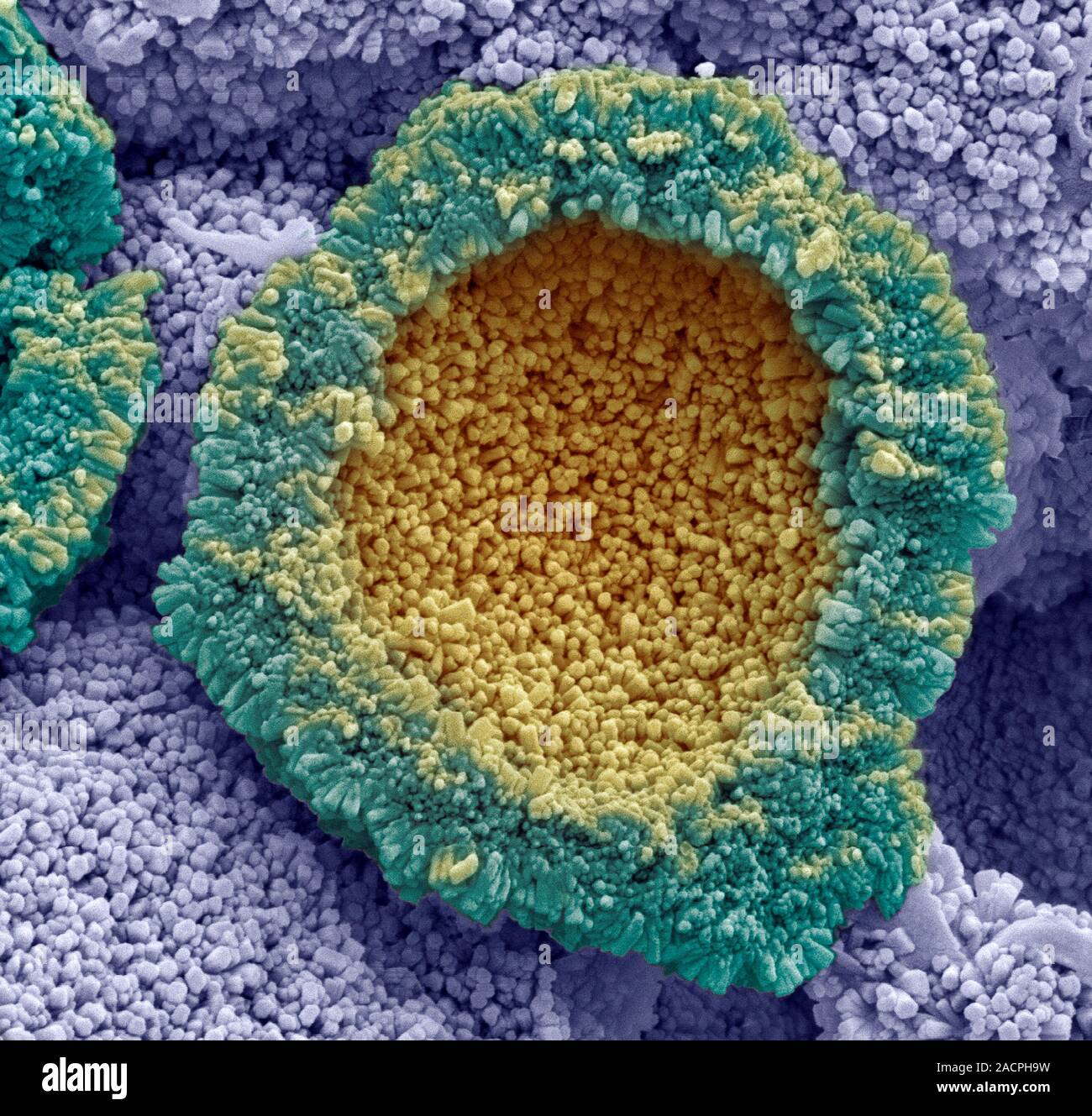 Fossilised dinosaur faeces. Coloured scanning electron micrograph (SEM ...