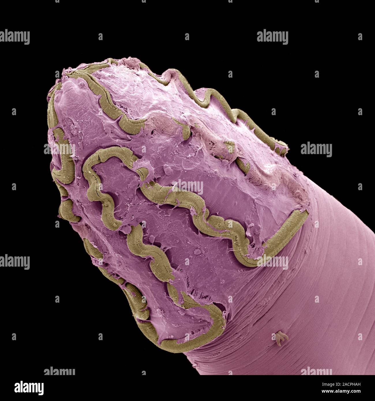Gapeworm head. Coloured scanning electron micrograph of the head of a ...