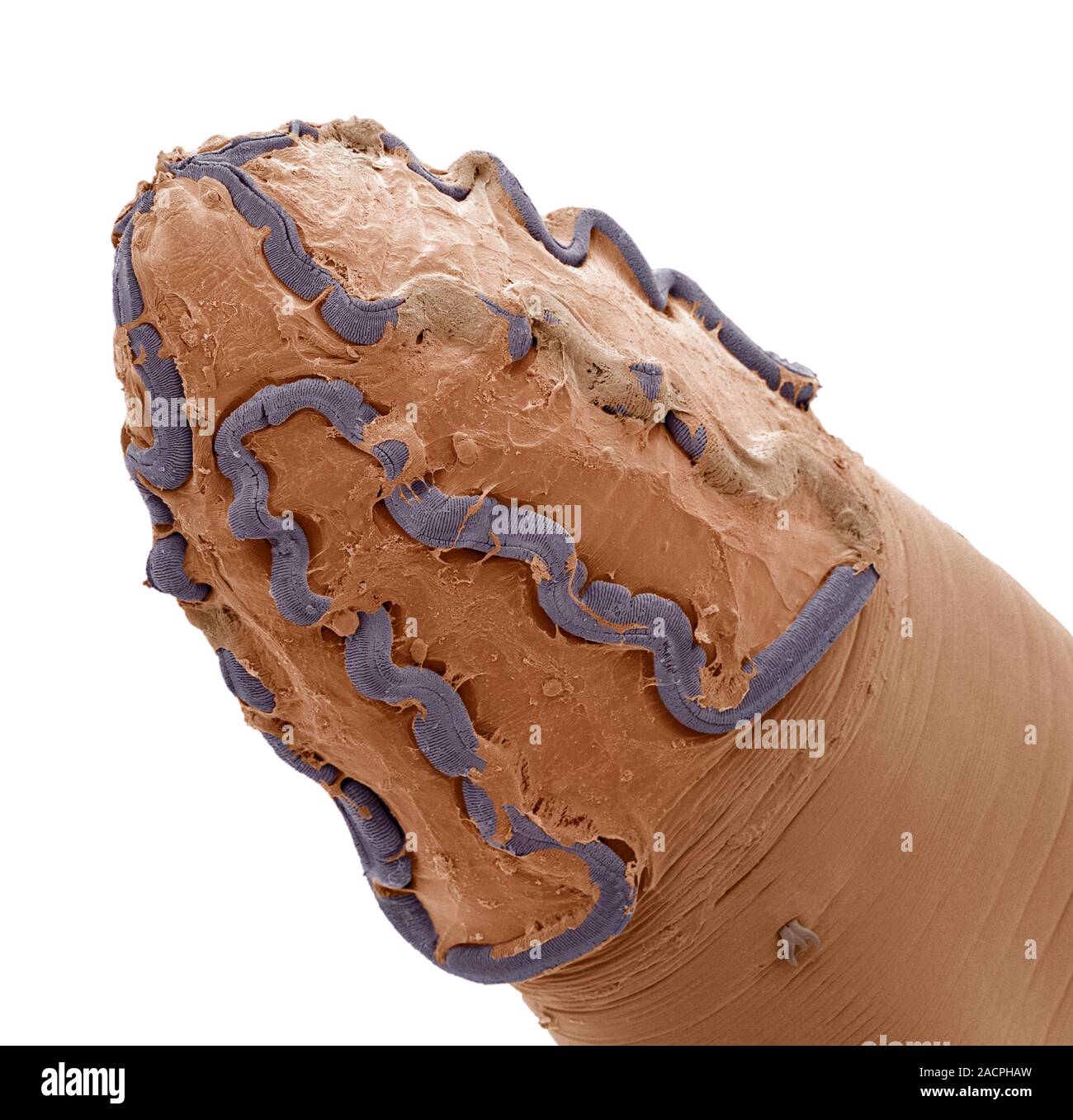 Gapeworm head. Coloured scanning electron micrograph of the head of a ...