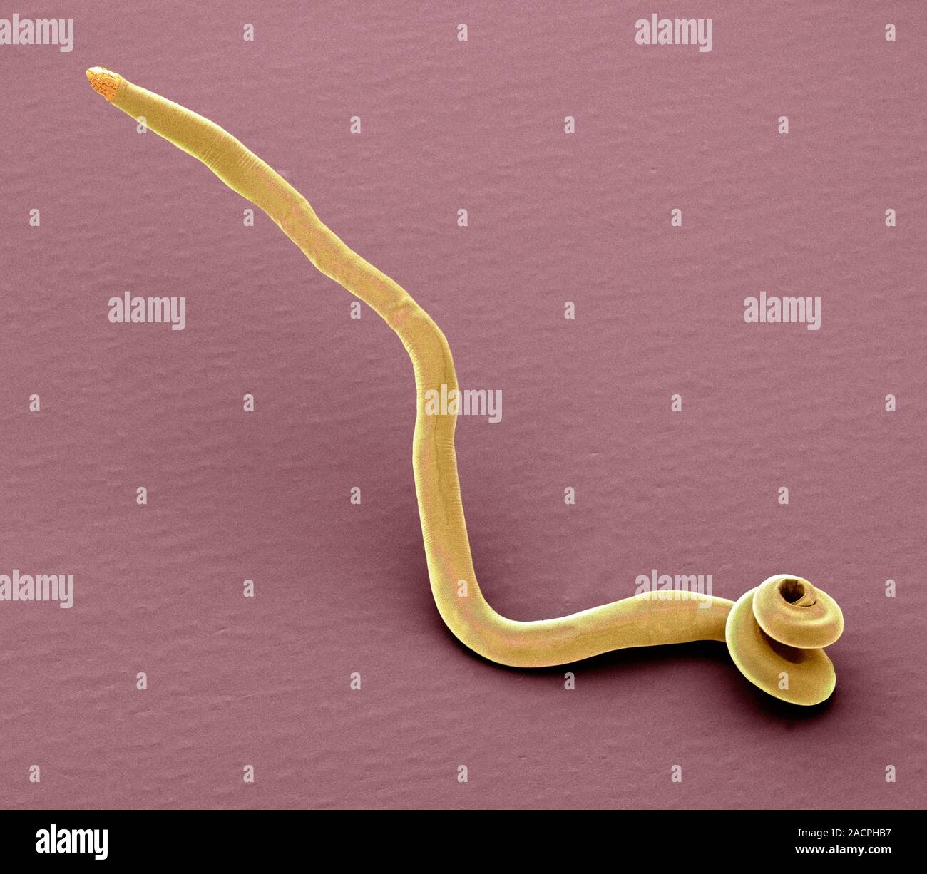 Gapeworm. Coloured scanning electron micrograph of a female gapeworm ...