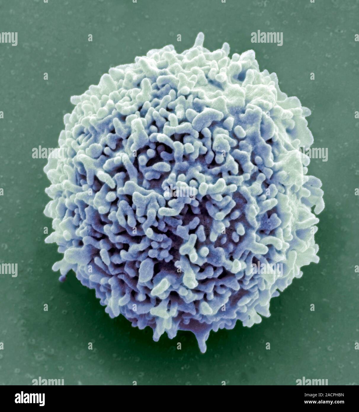 Lymphocyte white blood cell. Coloured scanning electron micrograph (SEM ...