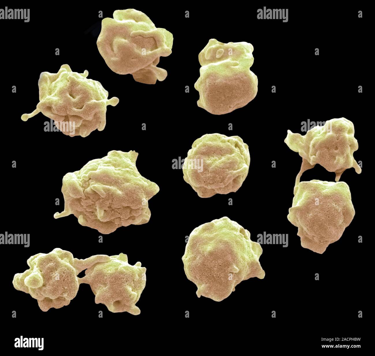 Platelets, coloured scanning electron micrograph (SEM). Platelets, or ...