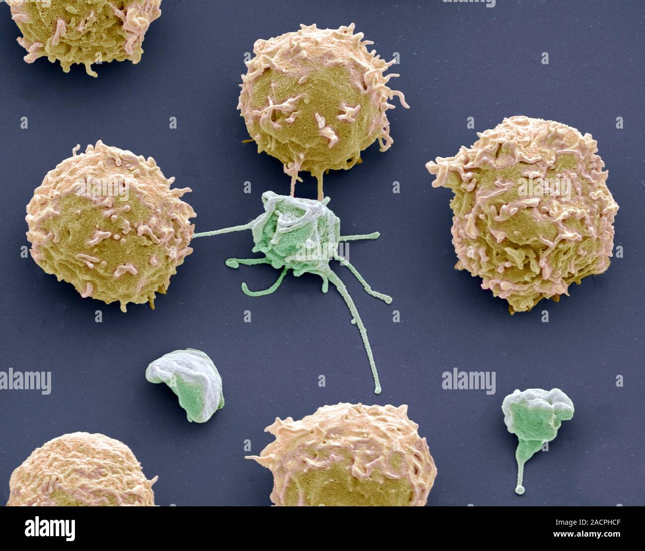 White blood cells and platelets. Coloured scanning electron micrograph ...