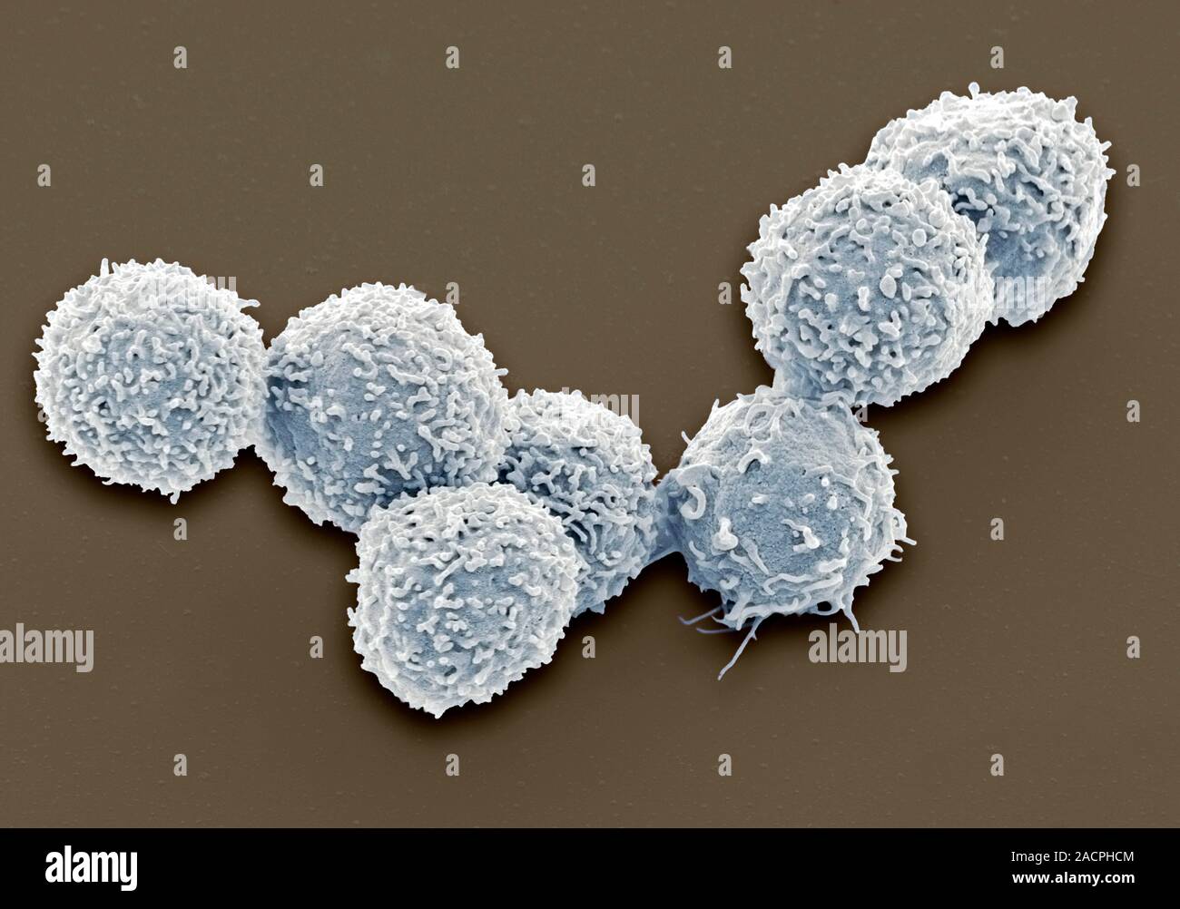 White blood cells. Coloured scanning electron micrograph (SEM) of white ...