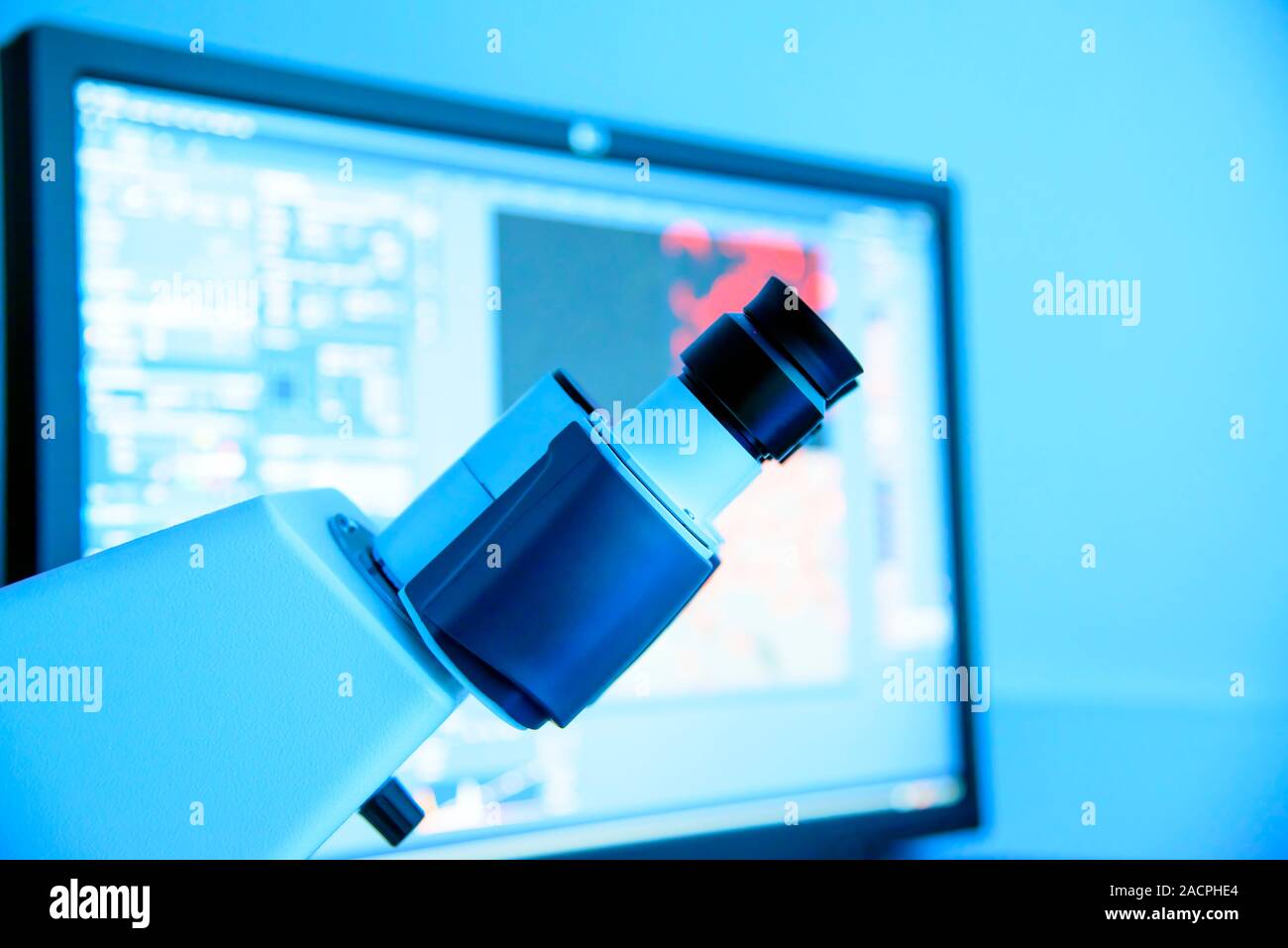 Confocal microscopy. Laser scanning confocal microscope in a laboratory ...