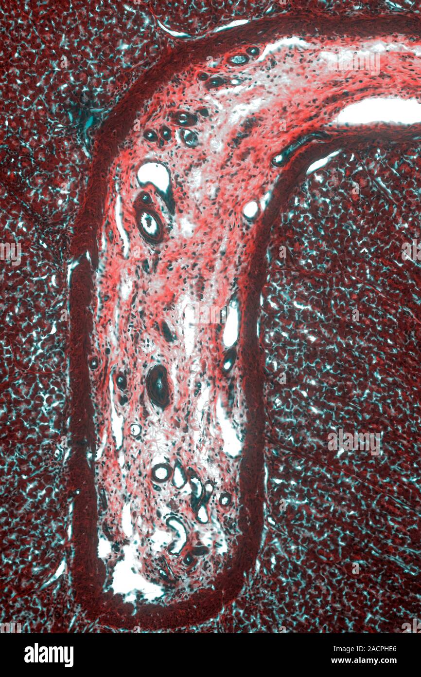 Stomach wall. Laser scanning confocal light micrograph of a section ...