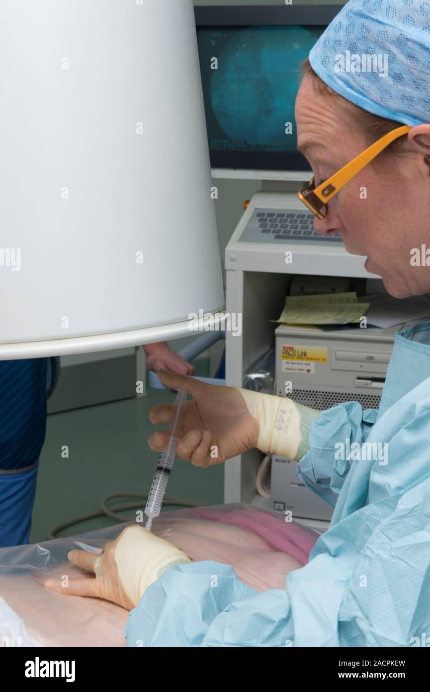 Lumbar anaesthetic injections. 65-year-old woman having a local ...