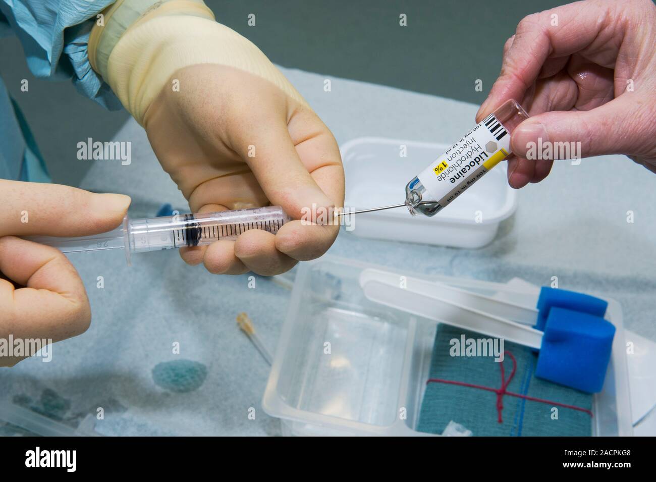 Lidocaine local anaesthetic. Doctors preparing a syringe of lidocaine ...