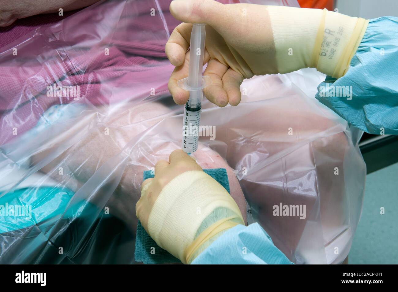 Knee pain treatment. 64-year-old female patient having local ...