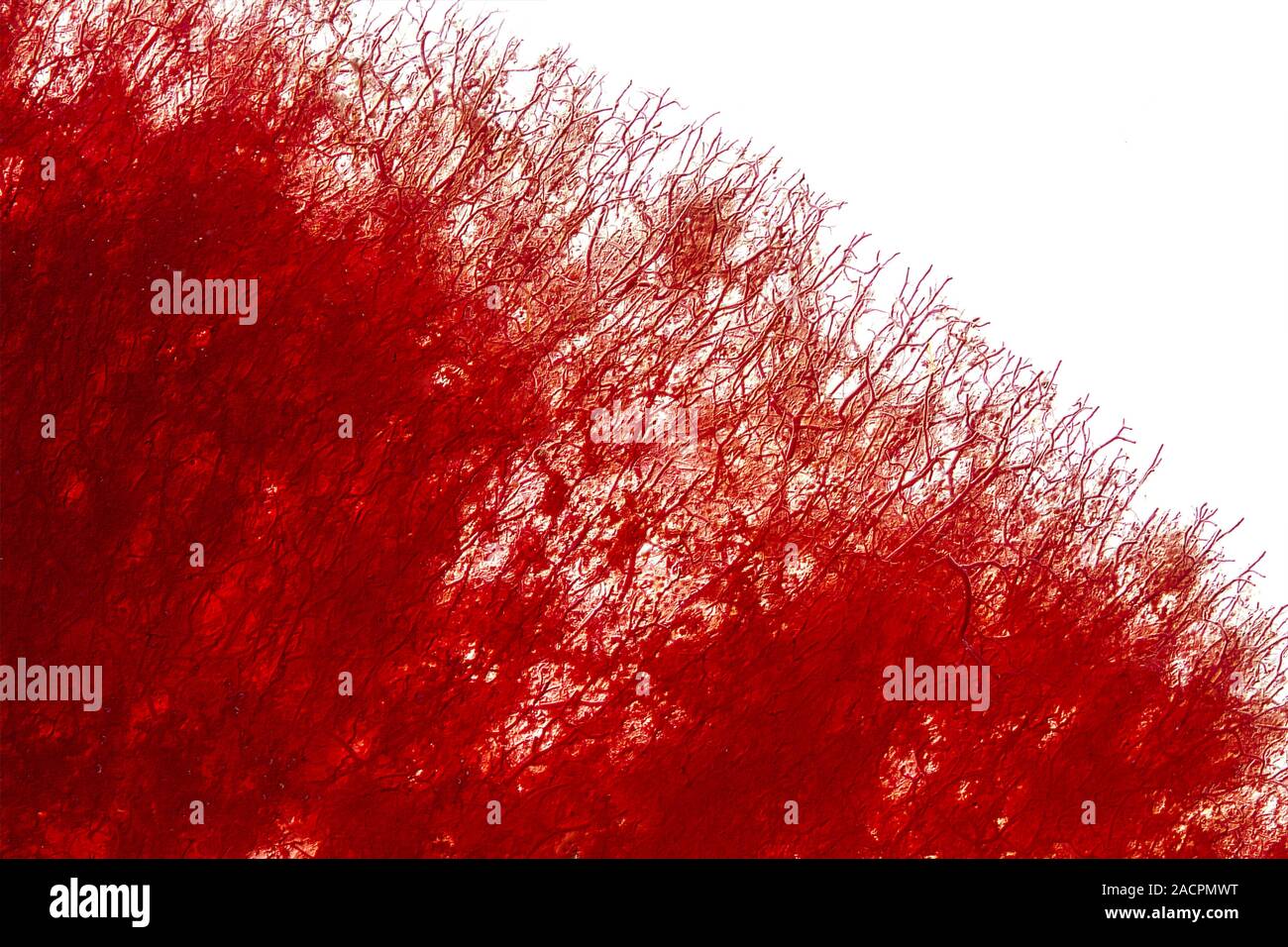 Detail of a resin cast of the blood supply to a human kidney, showing ...