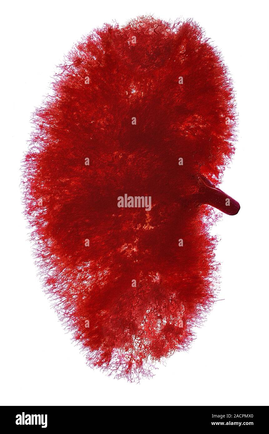 Resin cast of the blood supply to a human kidney, showing the dense ...