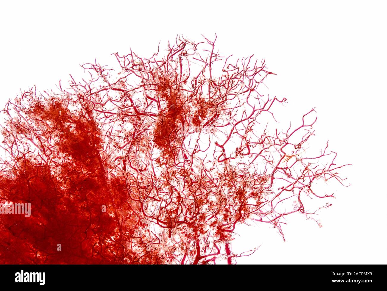 Detail of a resin cast of the blood supply to a human kidney, showing ...