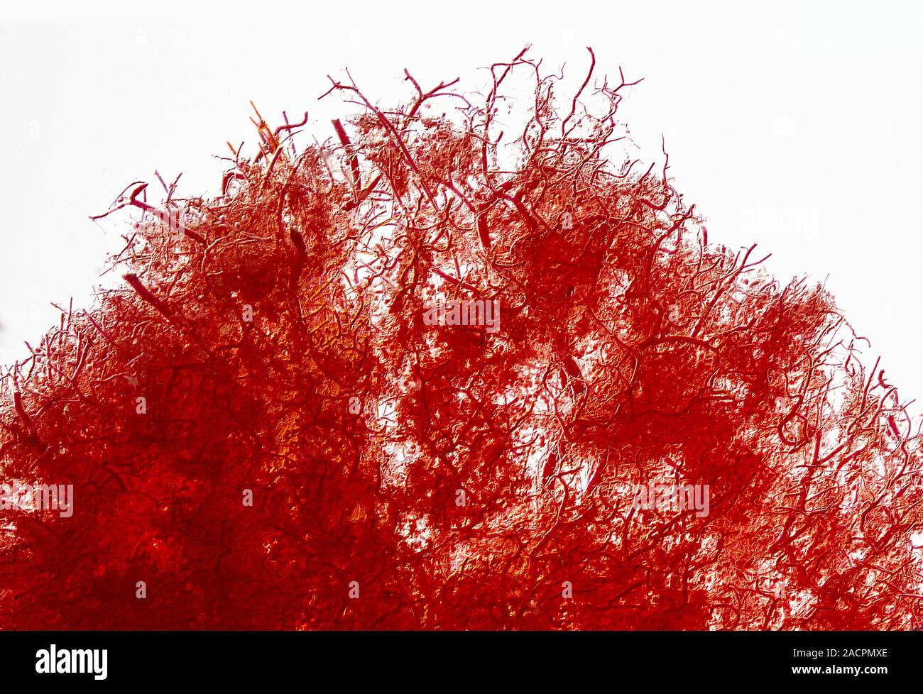 Detail of a resin cast of the blood supply to a human kidney, showing ...