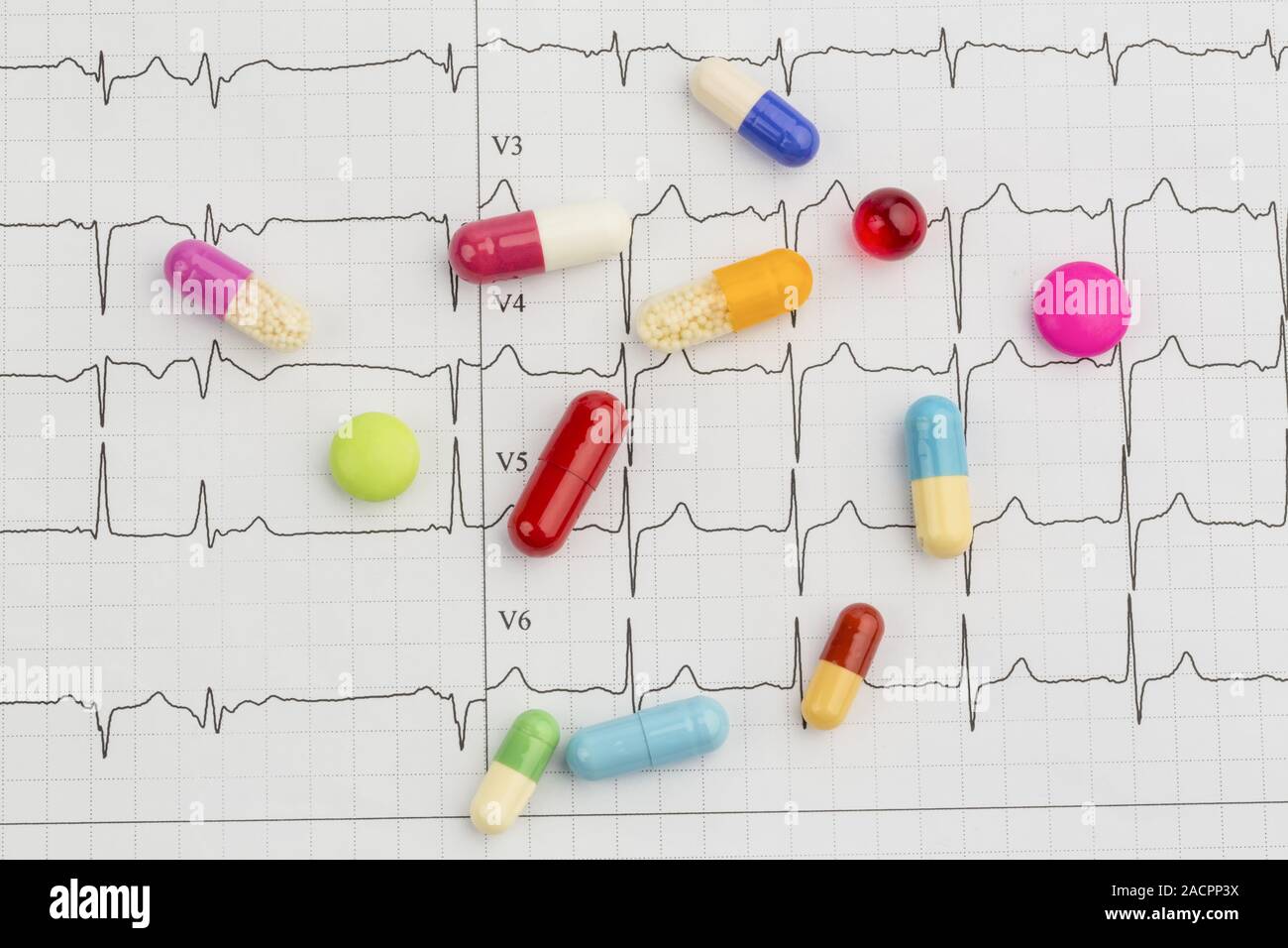Angina ecg hi-res stock photography and images - Alamy