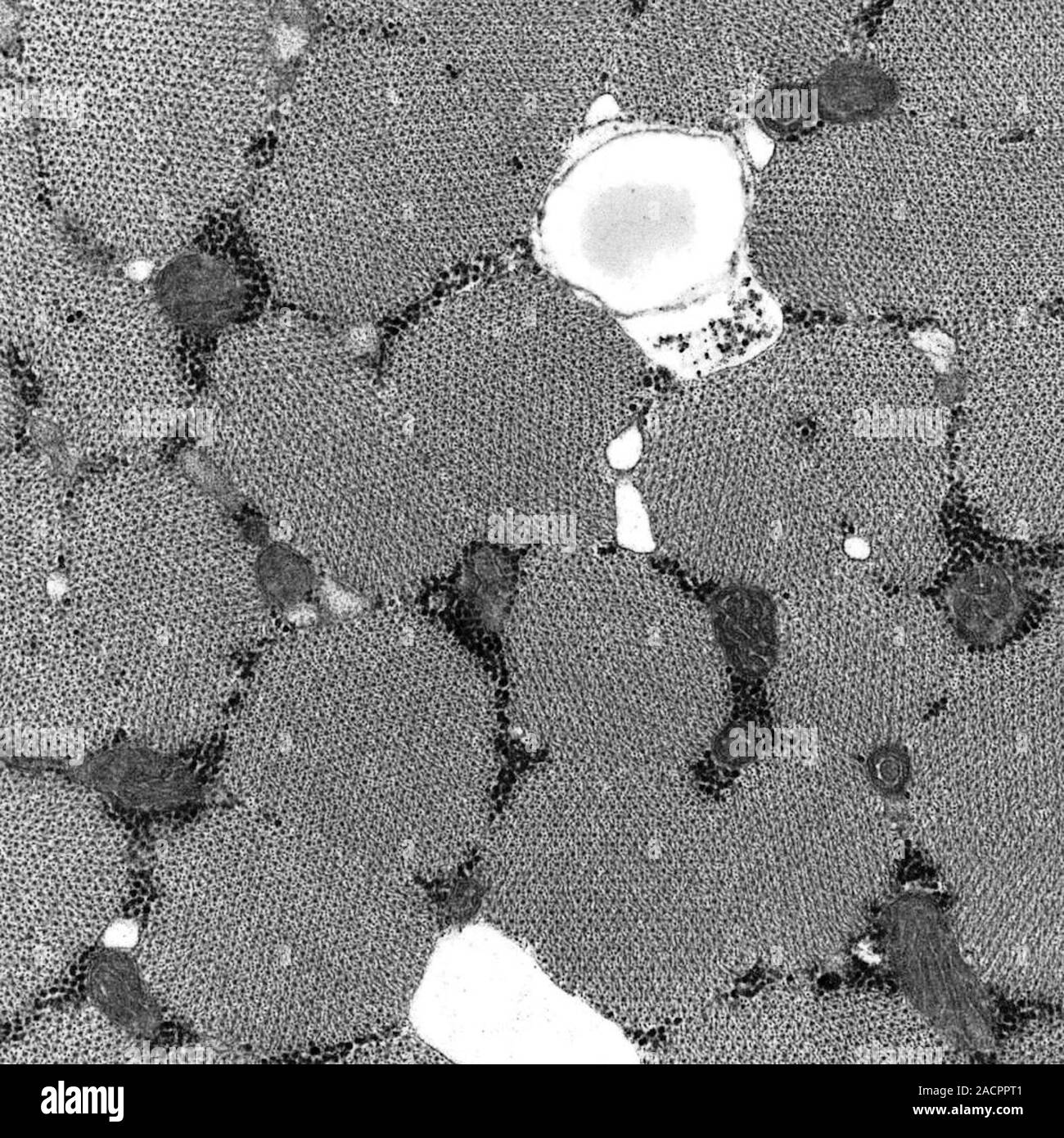Skeletal muscle. Transmission electron micrograph (TEM) of a cross ...
