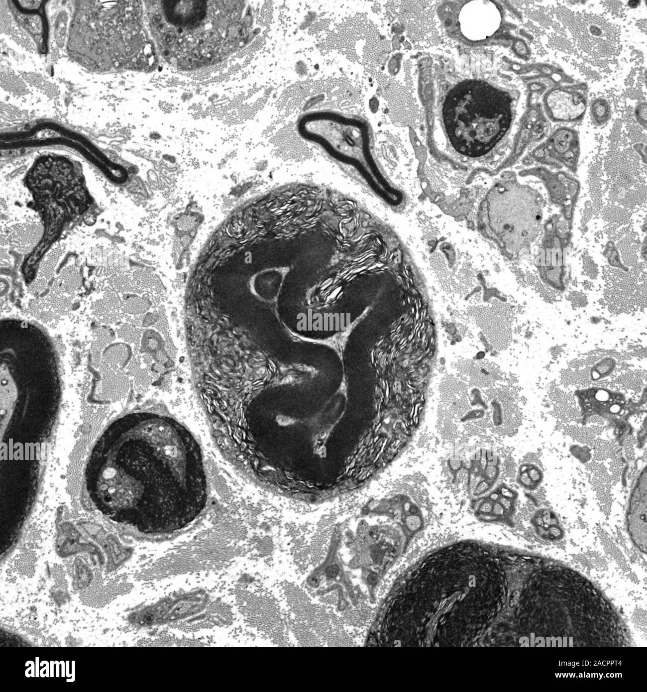 Myelinated nerve. Transmission electron micrograph (TEM) of a section ...