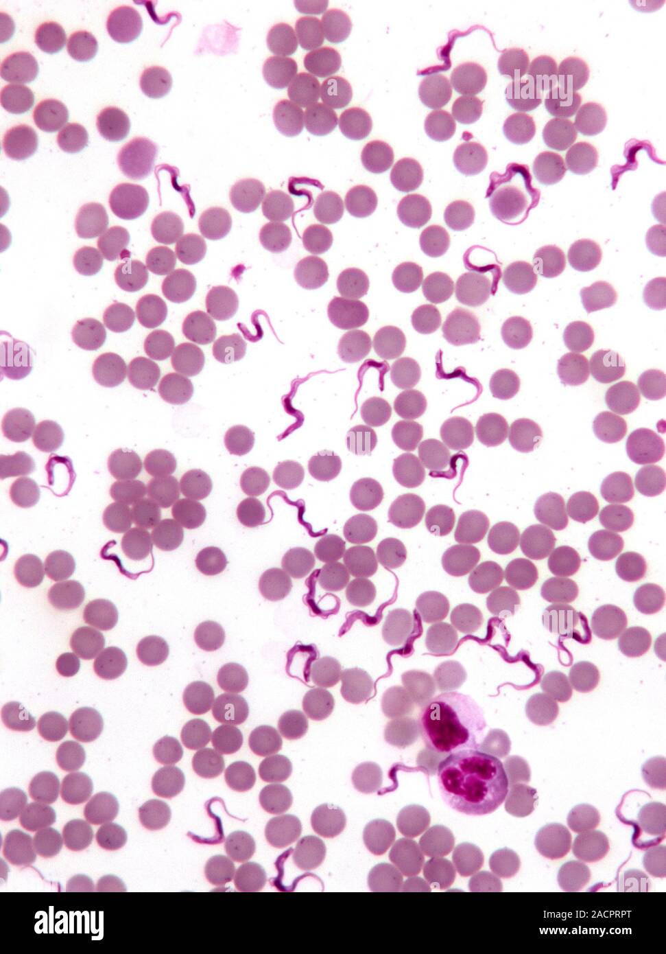 Parasitic protozoan. Light micrograph of trypanosome protozoa ...